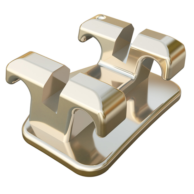 Iconix® Aesthetic Braces | American Orthodontics