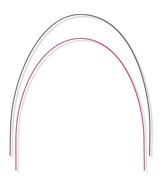 Arch Forms | American Orthodontics
