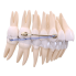 PowerBar® Class II Corrector | American Orthodontics