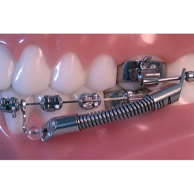 Jasper Jumper and Gentle Jumper | American Orthodontics