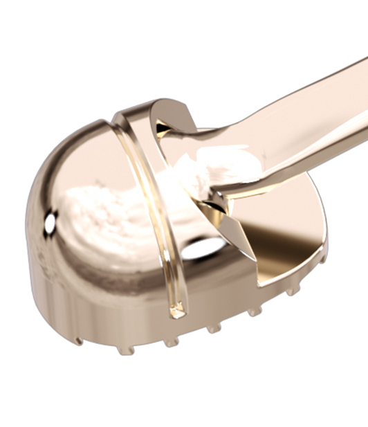 PowerBar® Class II Corrector | American Orthodontics